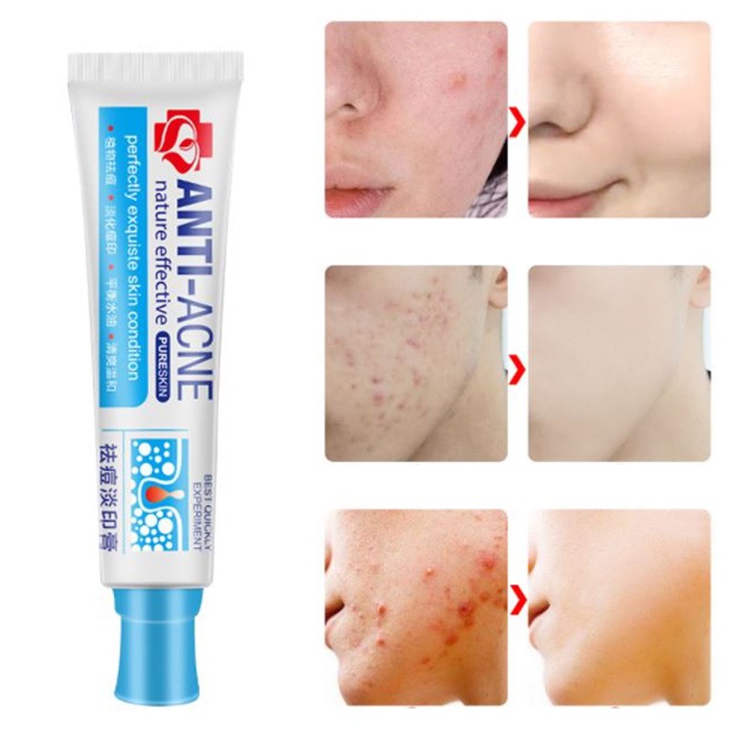 Relativo Mejorar sexo pomada para tirar manchas do rosto Quien distrito Incitar