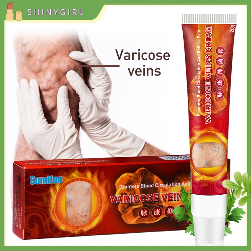 Pomada Varizes Para Reparo De Efeito Rápido De SG-20g Naturais ...