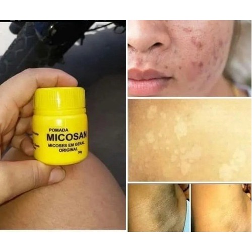 Pomada Micosan Micoses em Geral 50g Original | Shopee Brasil
