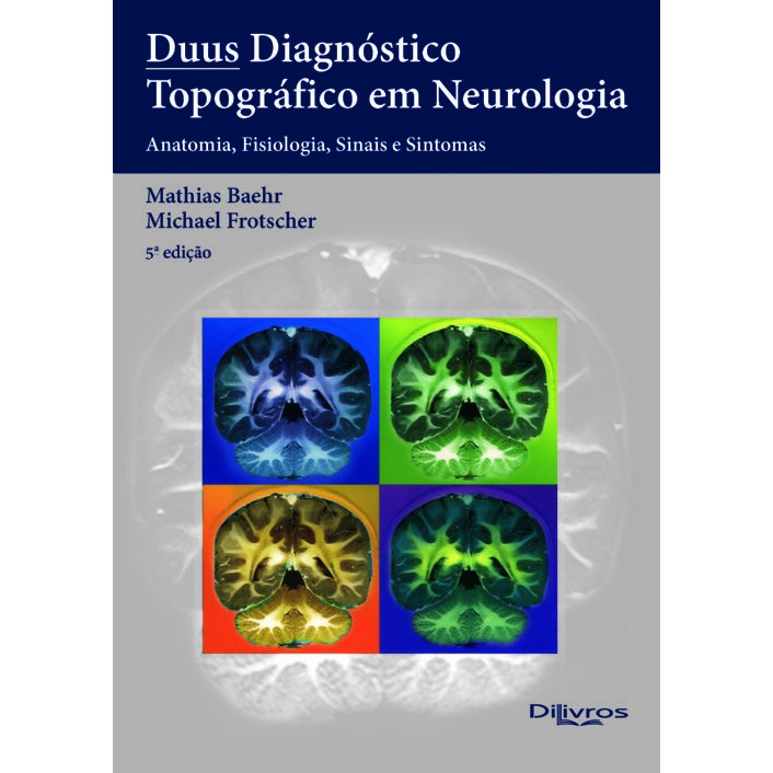 Livro Duus Diagnostico Topografico em Neurologia - Anatomia, fisiologia ...