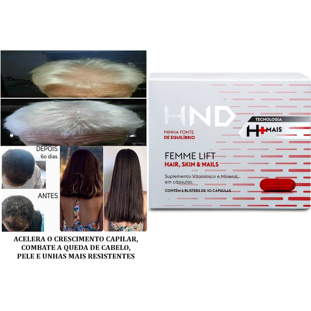 Hnd Femme Lift Para Cabelo, Pele & Unha 60 Cápsulas Hinode Original ...