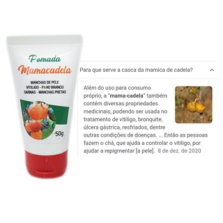 Pomada de mamacadela Tratamento Vitiligo Manchas De Pele Psoriase ...
