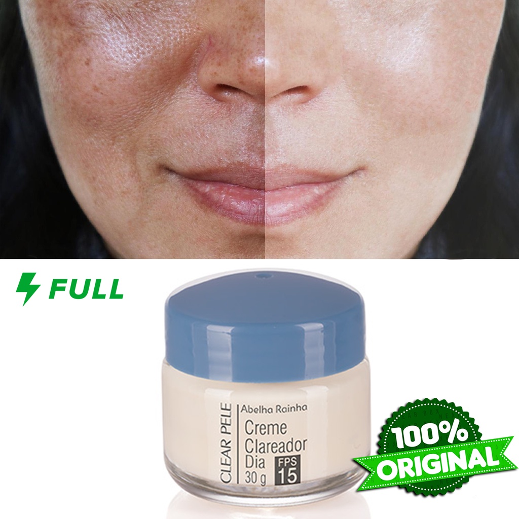 Creme Clareador Para Amenizar Melasma E Manchas Escur