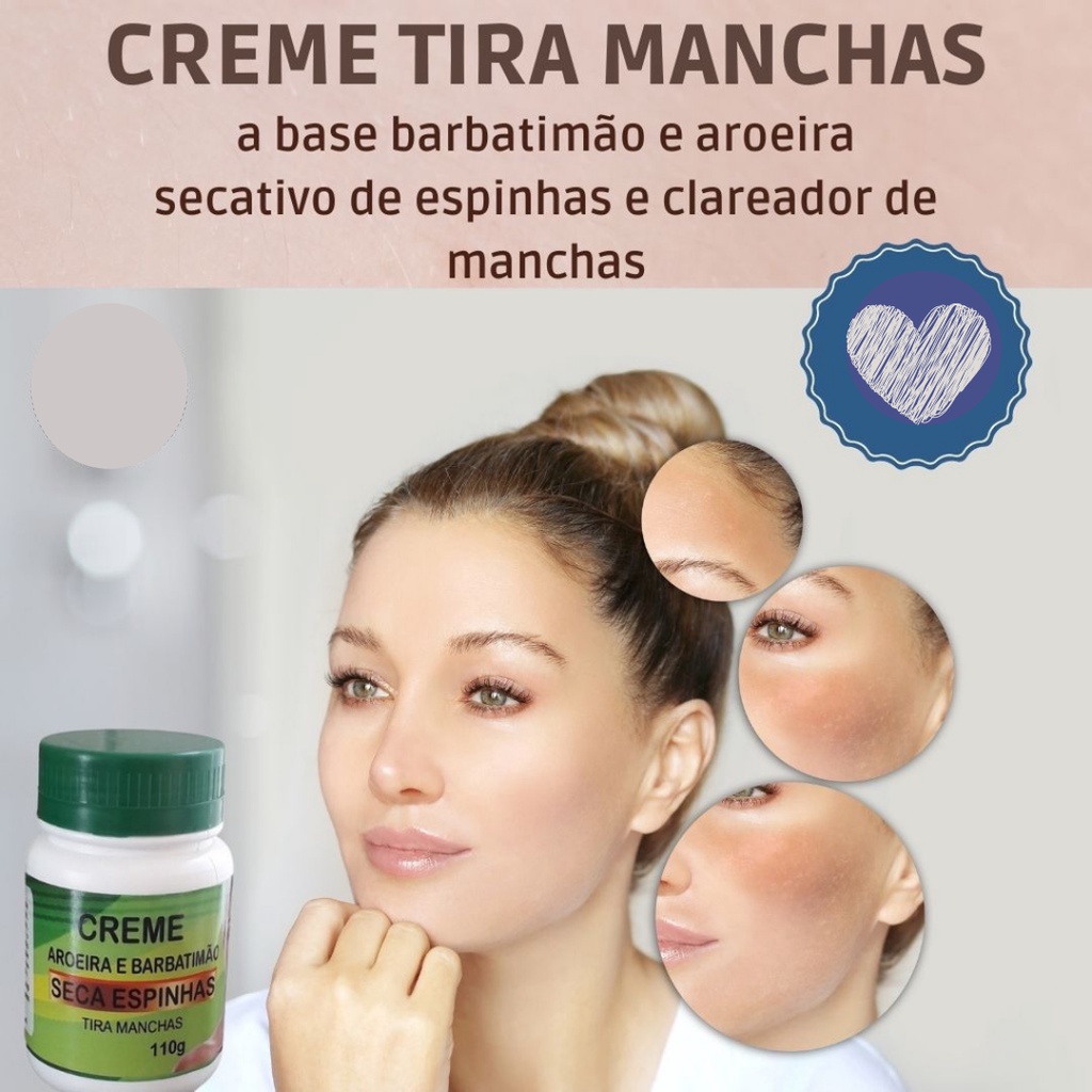 (1 creme aroeira)Tirar Manchas do Rosto com Creme Clareador e Secativo ...