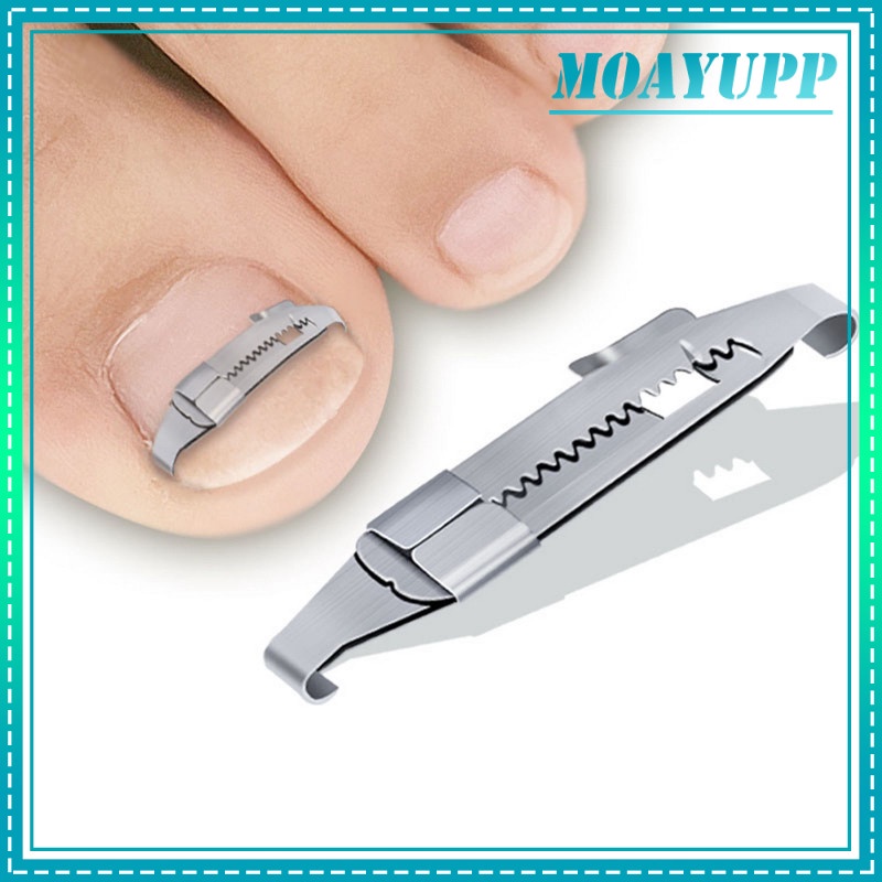 [moayupp] Ingrown Toenail Tools, Ingrown Toenail Correction Buckle for ...
