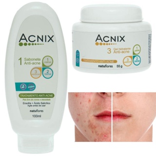 GEL HIDRATANTE ANTI-ACNE ACNIX 55G | Shopee Brasil