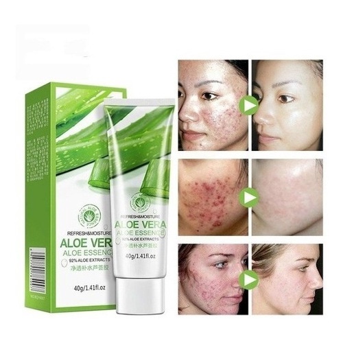 Creme Gel Clareador Melasma Manchas Cicatrizes Aloe Vera Shopee Brasil
