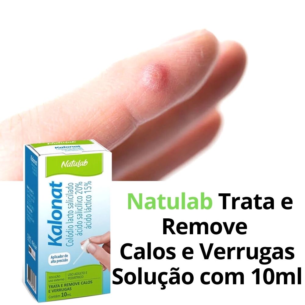 Trata e Remove Calo Verruga Olho de Peixe Calos Kalonat 10mL | Shopee ...