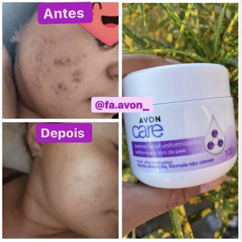 Creme Clareador Avon Care Uniformiza O Tom De Pele | Shopee Brasil
