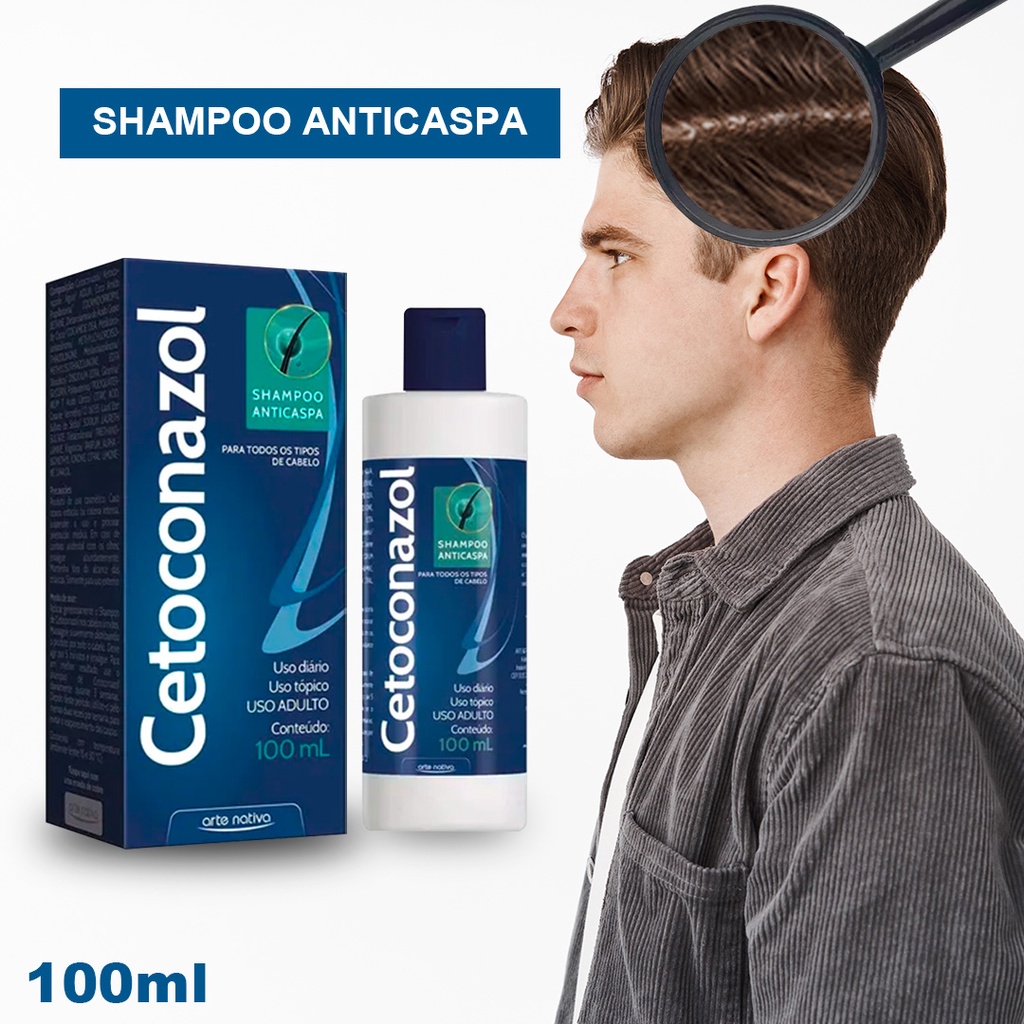 Cetoconazol Shampoo Anticaspa 100ml | Shopee Brasil